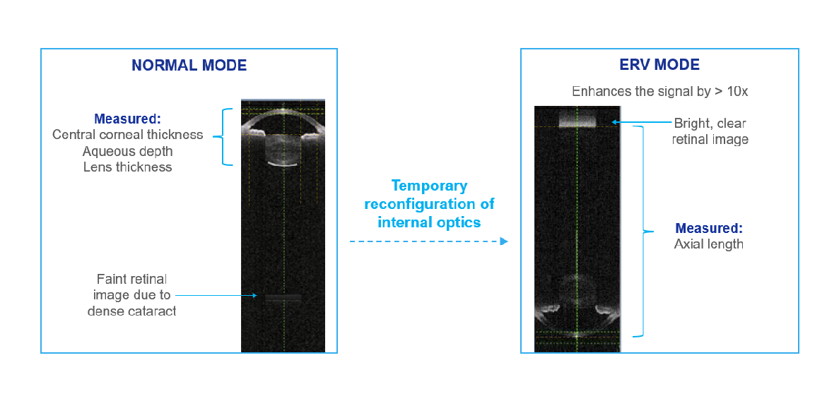 The ARGOS Biometer with Image Guidance | MyAlcon | International