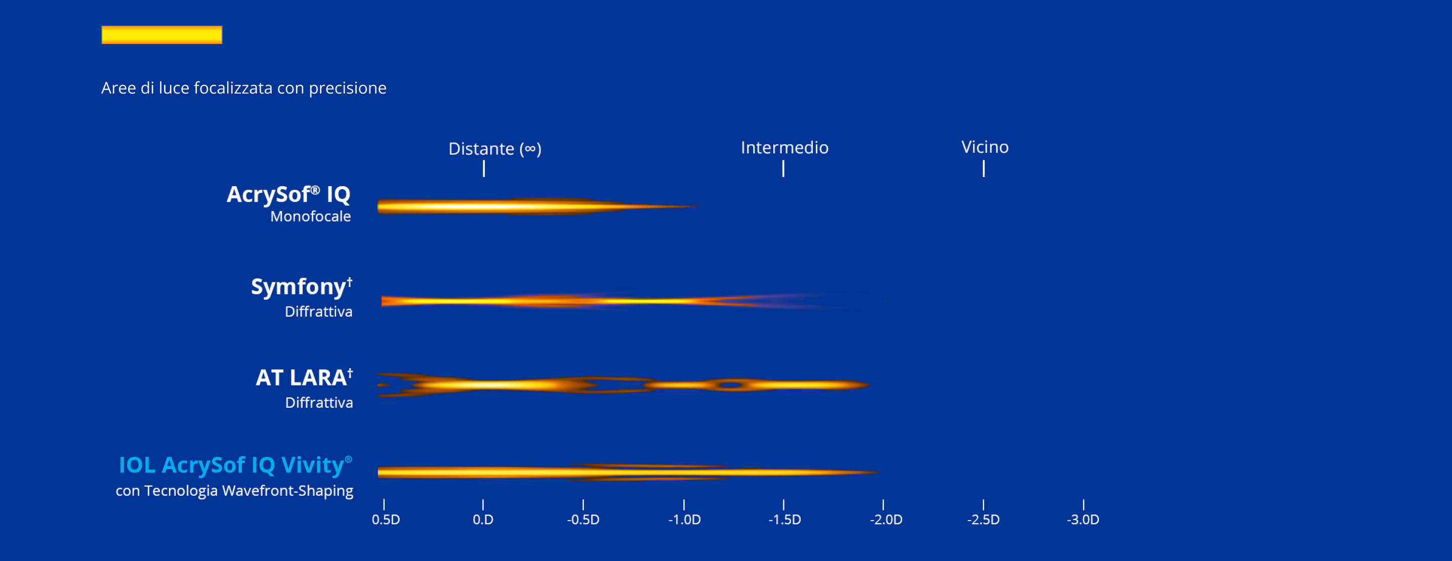 IOL AcrySof IQ Vivity | Semplificare la correzione della presbiopia ...
