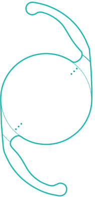 Clareon® Toric Intraocular Lens (IOL) for Astigmatism | Alcon
